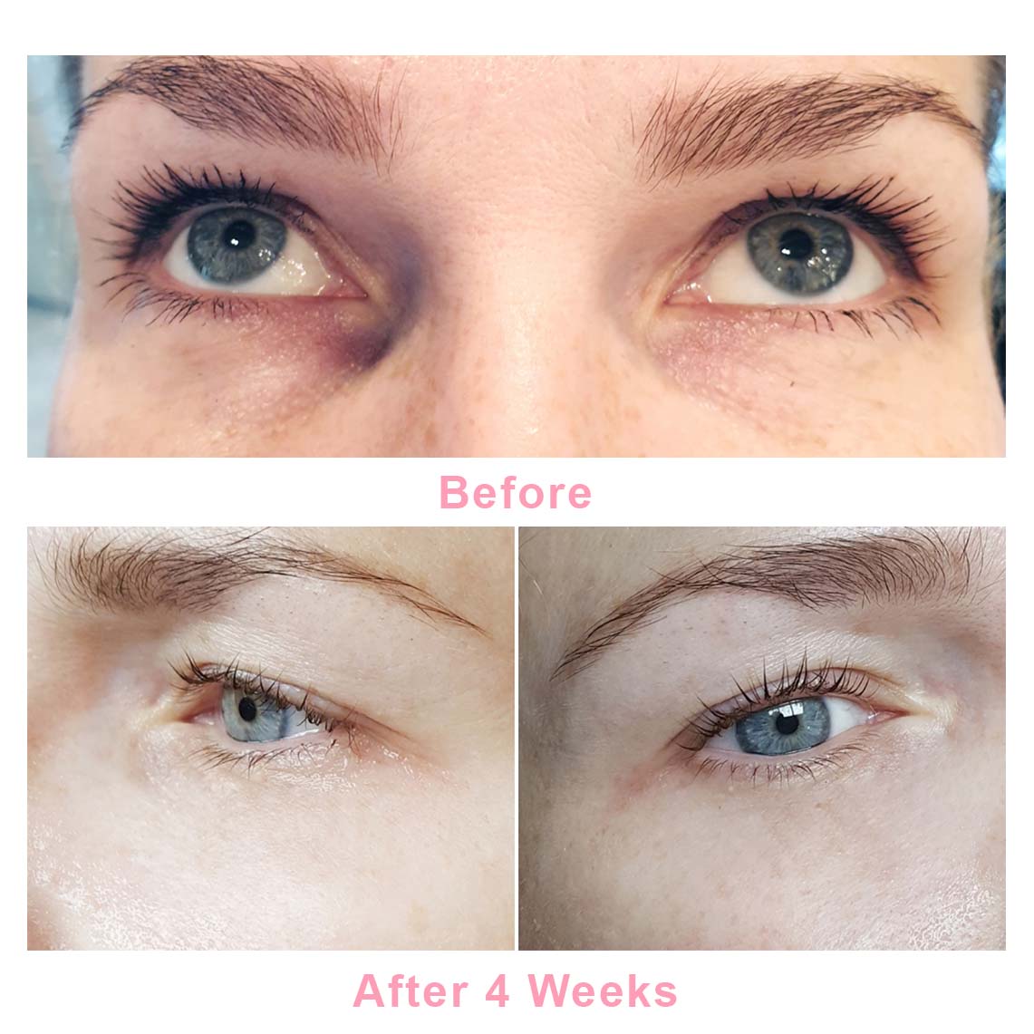 The Pink Treatment Before and Afters